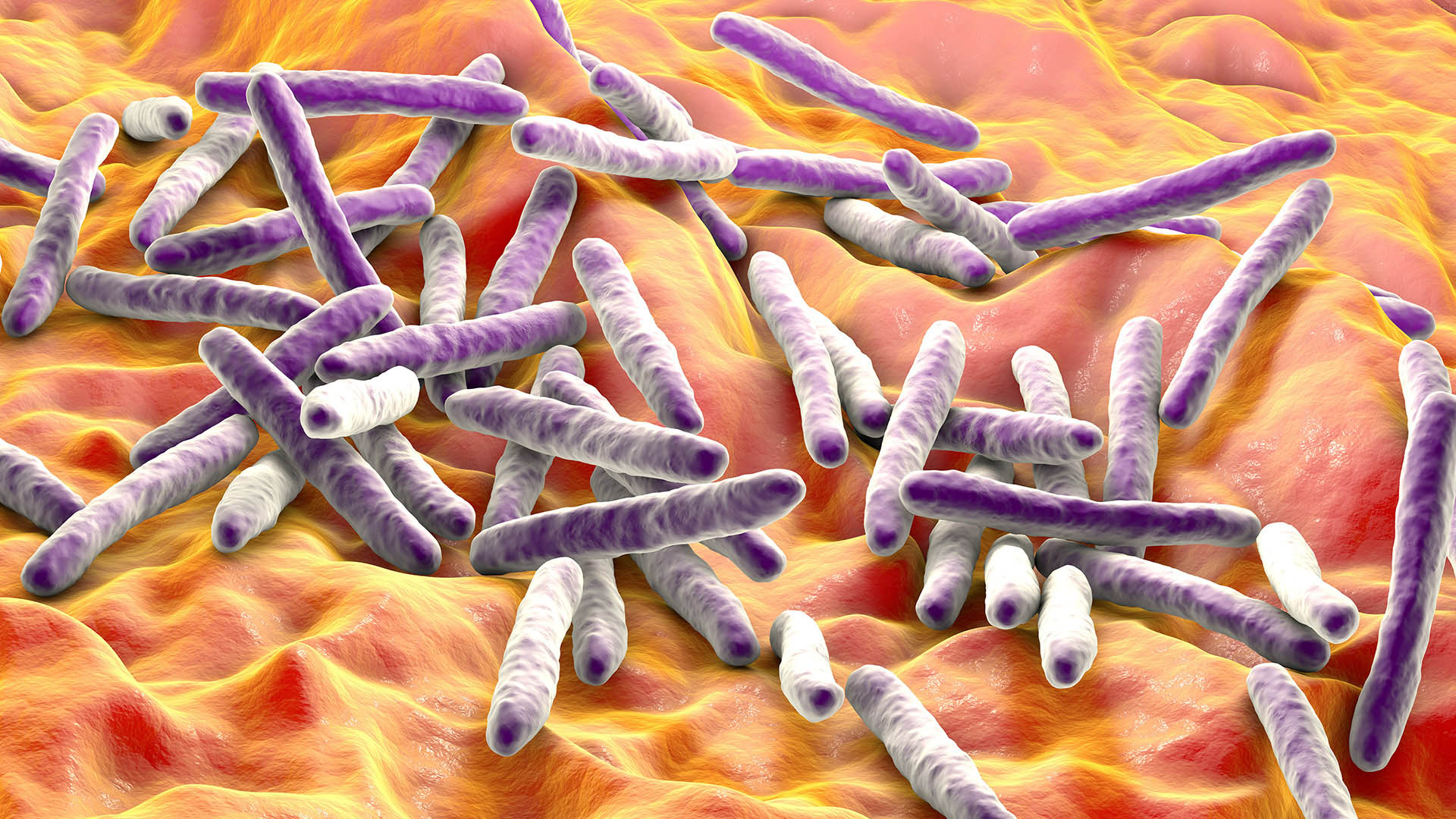 Taking down tuberculosis - JCU Australia